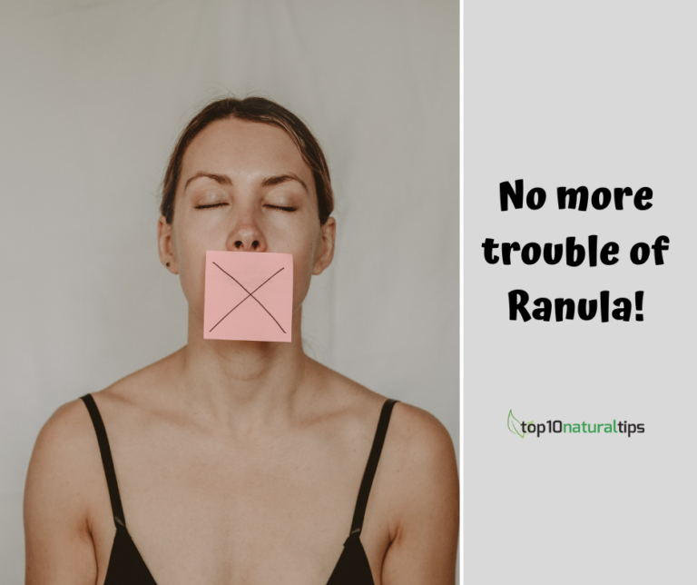 10 Effective Home Remedies to Treat Ranula - Top10 Natural Tips